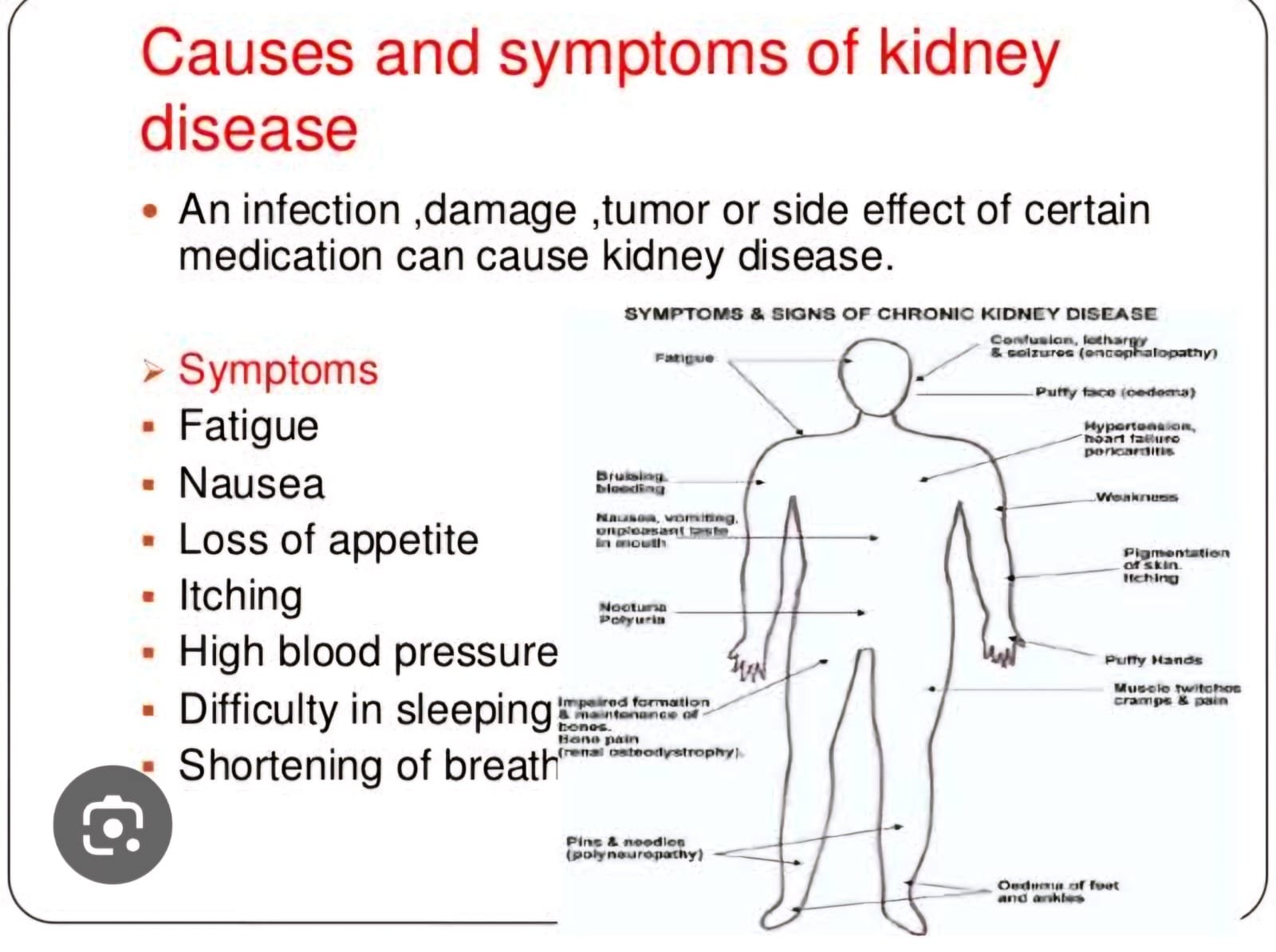 CAUSES, SYMPTOMS, PREVENTION, AND TREATMENT OF KIDNEYS DISEASE THROUGH ...